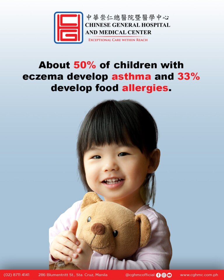 Understanding the Allergic or Atopic March - CGHMC